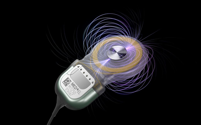 INTELLIGENT HEARING - MED EL | Κοχλιακά Εμφυτεύματα - Med-El ...