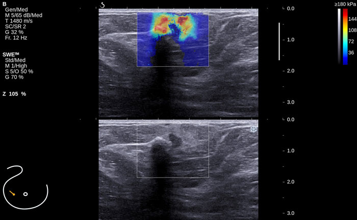 ΑΠΕΙΚΟΝΙΣΗ ΜΑΣΤΟΥ - Φωτογραφίες | Εξειδικευόμαστε στην Απεικόνιση & στη ...