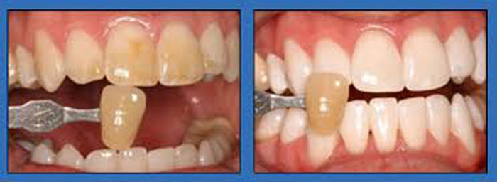 DENTAL SOLUTION – ΜΑΝΩΛΙΑΔΗΣ ΧΡΗΣΤΟΣ - Φωτογραφίες | Οδοντιατρική ...