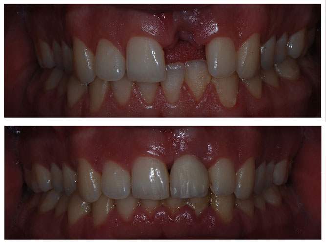 SPECIALIZED DENTISTRY OF ATHENS - ΛΩΛΗΣ Θ. ΧΡΗΣΤΟΣ | Αισθητική ...