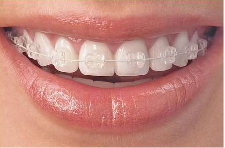 ORTHOCLINICS - ΠΑΠΑΔΟΠΟΥΛΟΣ ΝΙΚΟΛΑΟΣ | Ειδικός Ορθοδοντικός ...