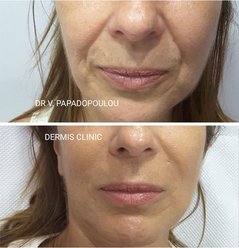 DERMIS CLINIC - ΠΑΠΑΔΟΠΟΥΛΟΥ ΒΑΣΙΛΙΚΗ - Φωτογραφίες | Δερματολόγος ...