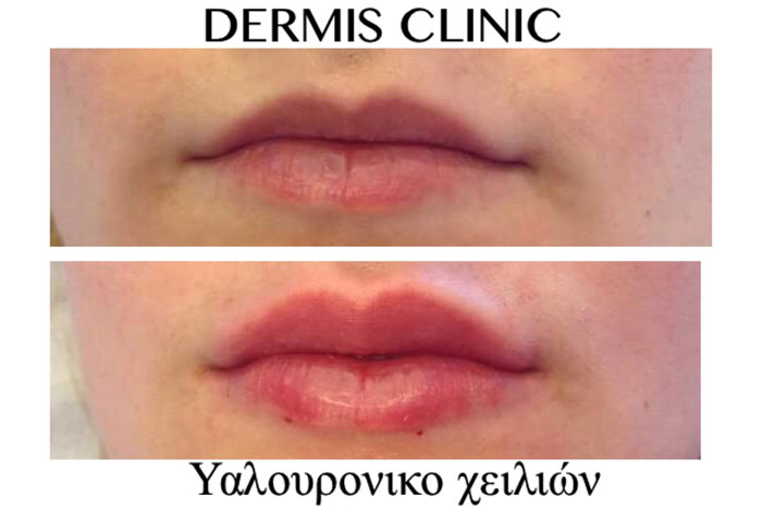 DERMIS CLINIC - ΠΑΠΑΔΟΠΟΥΛΟΥ ΒΑΣΙΛΙΚΗ - Φωτογραφίες | Δερματολόγος ...