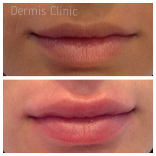 DERMIS CLINIC - ΠΑΠΑΔΟΠΟΥΛΟΥ ΒΑΣΙΛΙΚΗ - Φωτογραφίες | Δερματολόγος ...
