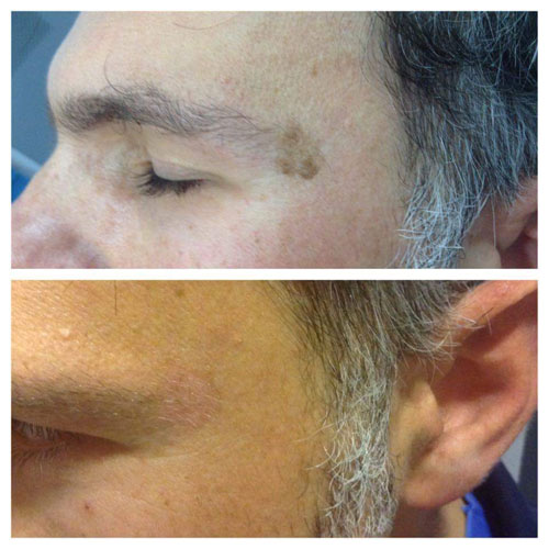 DERMIS CLINIC - ΠΑΠΑΔΟΠΟΥΛΟΥ ΒΑΣΙΛΙΚΗ - Φωτογραφίες | Δερματολόγος ...
