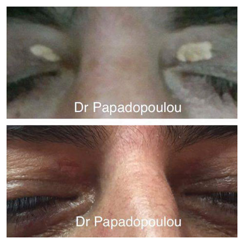 DERMIS CLINIC - ΠΑΠΑΔΟΠΟΥΛΟΥ ΒΑΣΙΛΙΚΗ - Φωτογραφίες | Δερματολόγος ...