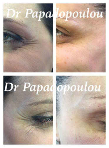 DERMIS CLINIC - ΠΑΠΑΔΟΠΟΥΛΟΥ ΒΑΣΙΛΙΚΗ - Φωτογραφίες | Δερματολόγος ...
