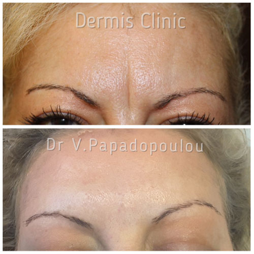 DERMIS CLINIC - ΠΑΠΑΔΟΠΟΥΛΟΥ ΒΑΣΙΛΙΚΗ - Φωτογραφίες | Δερματολόγος ...