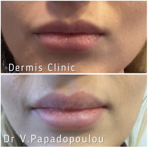 DERMIS CLINIC - ΠΑΠΑΔΟΠΟΥΛΟΥ ΒΑΣΙΛΙΚΗ - Φωτογραφίες | Δερματολόγος ...