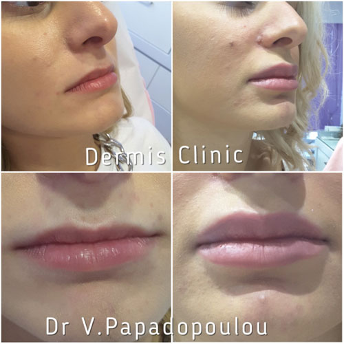 DERMIS CLINIC - ΠΑΠΑΔΟΠΟΥΛΟΥ ΒΑΣΙΛΙΚΗ - Φωτογραφίες | Δερματολόγος ...
