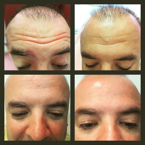 DERMIS CLINIC - ΠΑΠΑΔΟΠΟΥΛΟΥ ΒΑΣΙΛΙΚΗ - Φωτογραφίες | Δερματολόγος ...