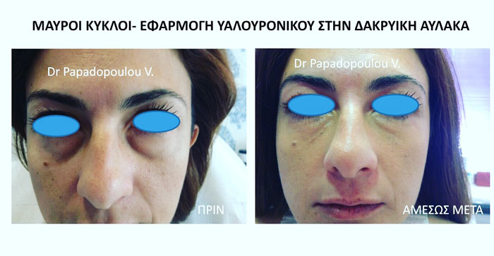 DERMIS CLINIC - ΠΑΠΑΔΟΠΟΥΛΟΥ ΒΑΣΙΛΙΚΗ - Φωτογραφίες | Δερματολόγος ...