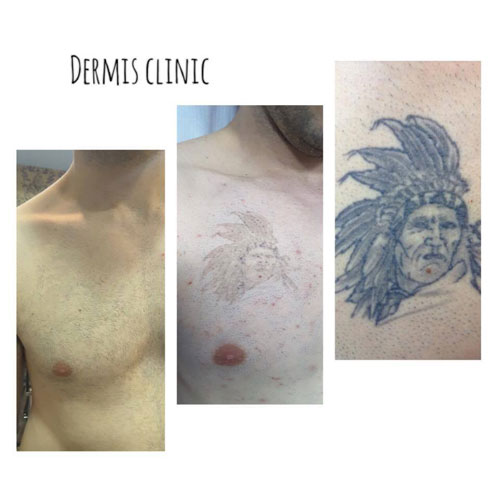DERMIS CLINIC - ΠΑΠΑΔΟΠΟΥΛΟΥ ΒΑΣΙΛΙΚΗ - Φωτογραφίες | Δερματολόγος ...